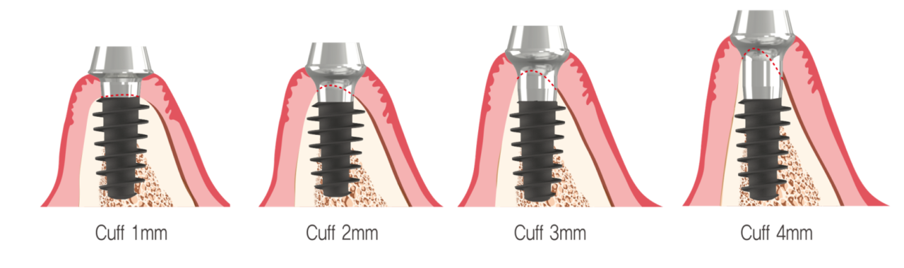 MagiCore | IBS Europe