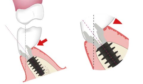 MagiCore | IBS Europe